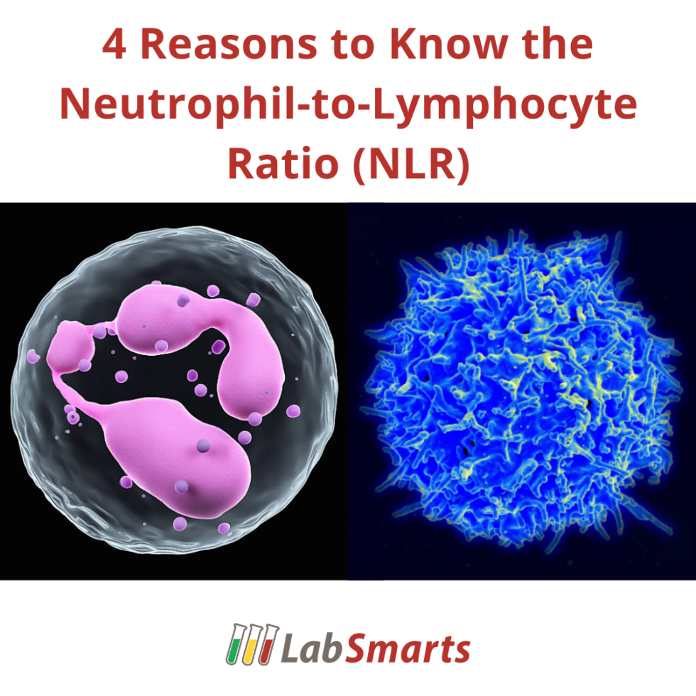 Blood Work Interpretation Software for Practitioners - LabSmarts